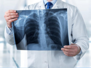 Emoyamed Radiology – Accurate Radiological Diagnosis